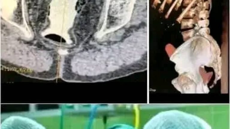 Si te pide practicar el s3x0 4nal tienes que saber…. – foreverhealt ...